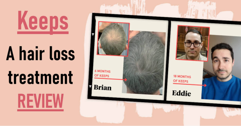 Best Hair Loss Treatment–Compare Happy Head vs. Keeps w/Cost