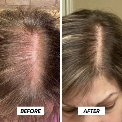 2026 Musely Reviews: Before/After Pics Reveal Shocking Truth!