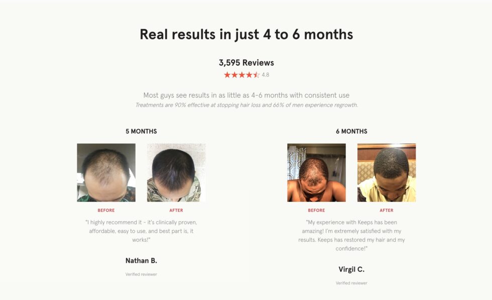 Happy Head vs. Hims vs. Keeps to Regrow Hair & Stop Hair Loss
